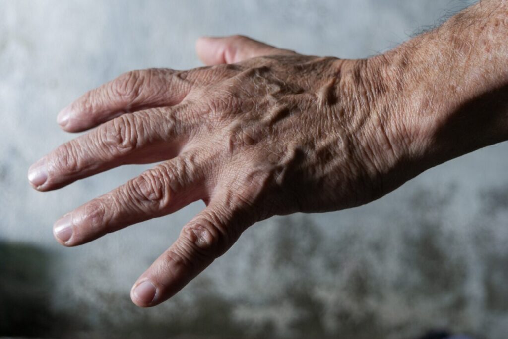 If you have visible veins it means you are… - Spirit Wings